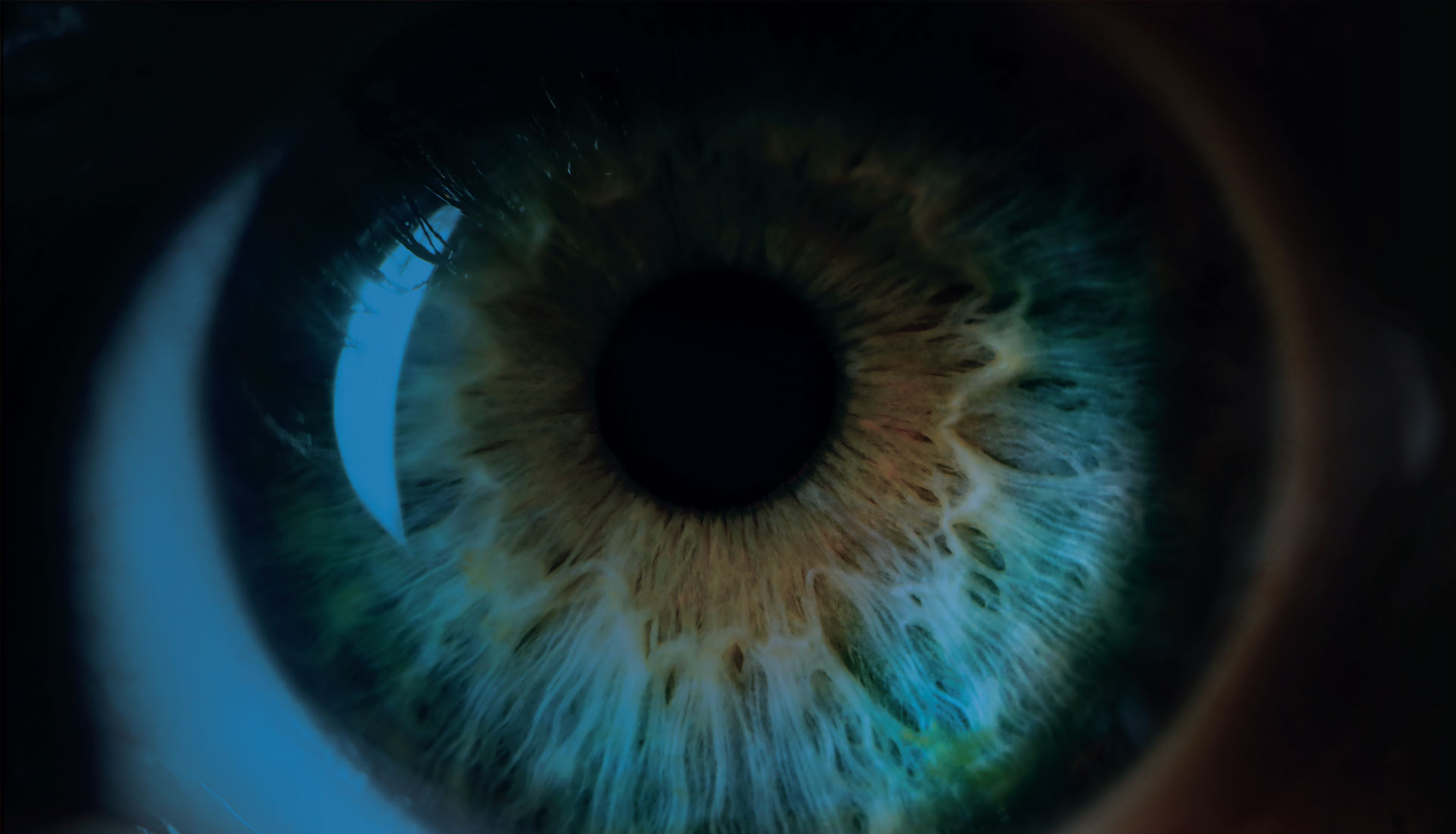 Oculus Medical Services - Dr. Josh Ramkissoon | Ophthalmologist ...